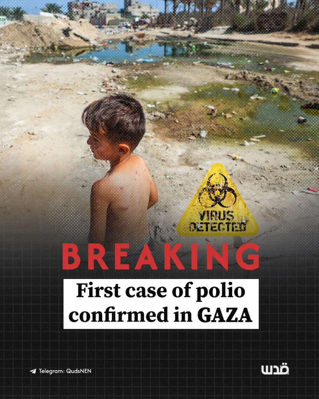 Premier cas avéré de polio à Gaza – CAPJPO EuroPalestine